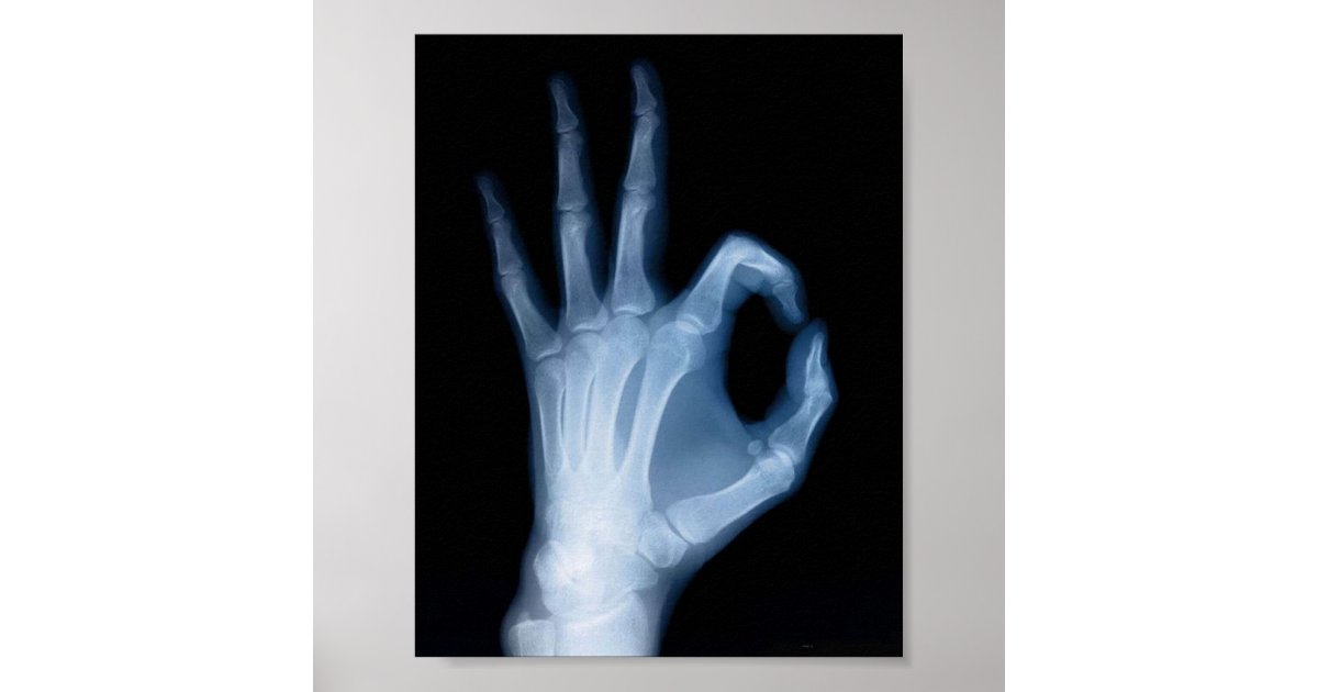 A-OK X-RAY POSTER | Zazzle