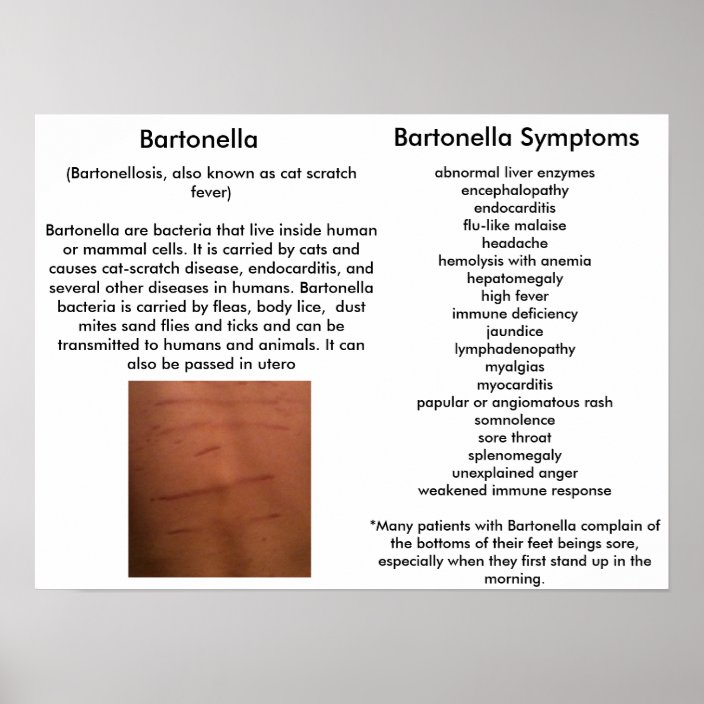 Bartonella Symptoms Educational Poster | Zazzle.co.uk