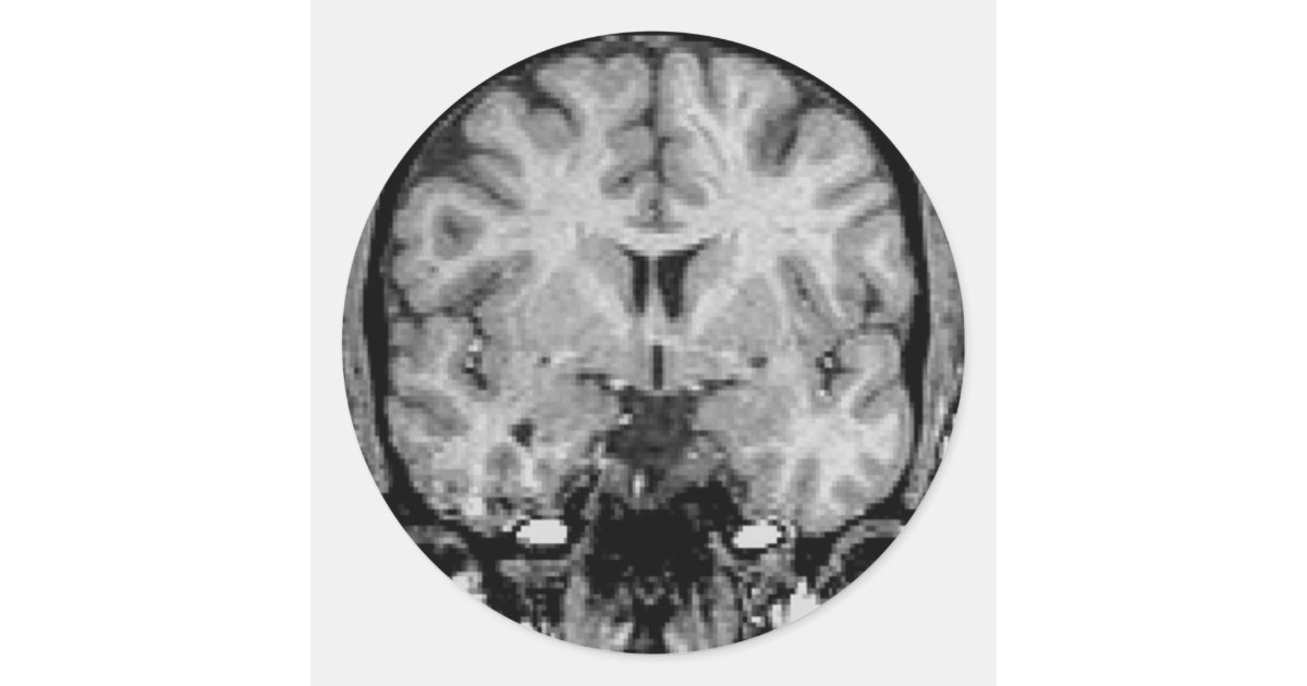Brain MRI, coronal slice Classic Round Sticker | Zazzle