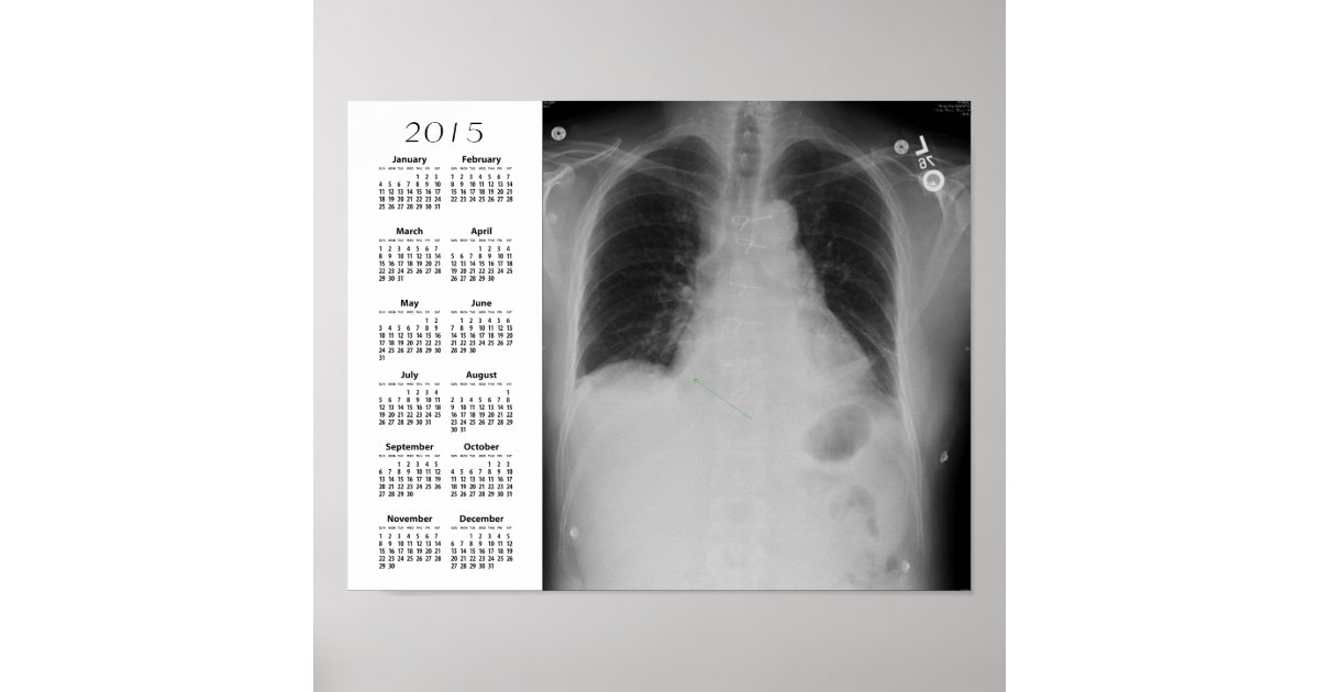 Chest X Ray calendar ~ Poster | Zazzle