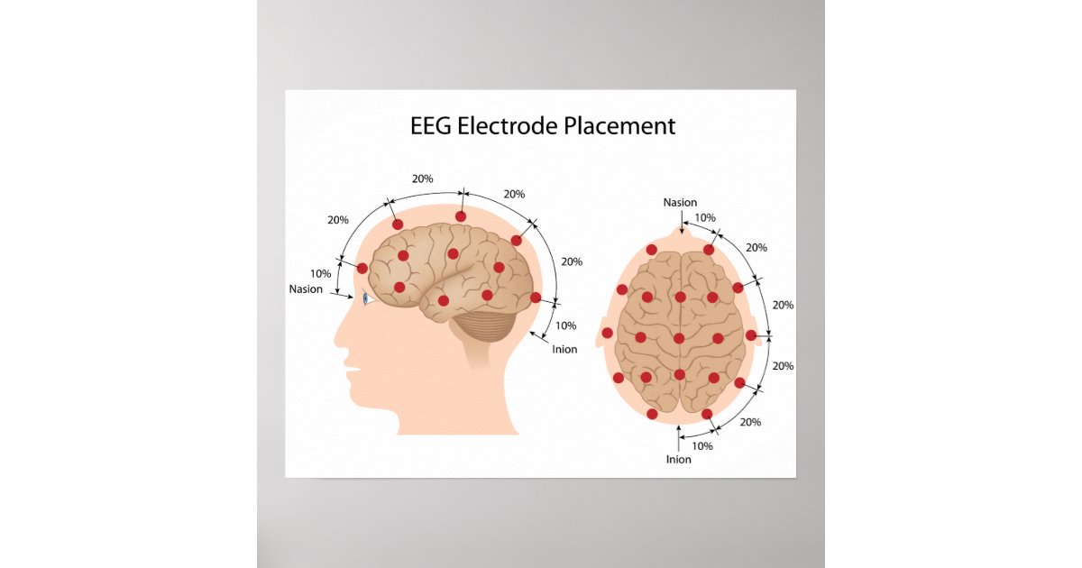EEG electrode placement diagram Poster | Zazzle