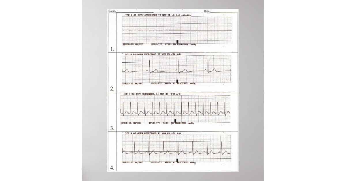 ekg Rhythms Poster | Zazzle