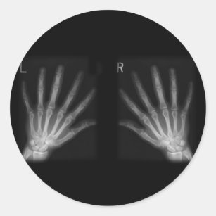 X Ray Stickers & Labels | Zazzle UK