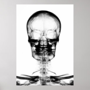Xray Posters & Prints | Zazzle UK