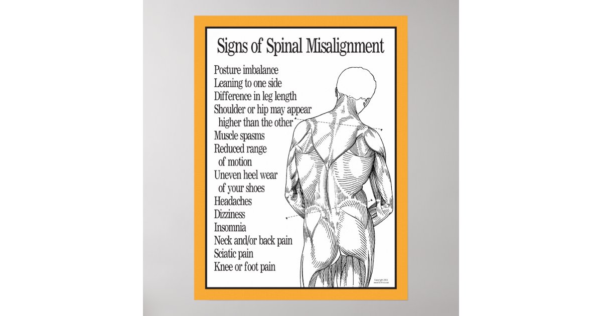 Signs of Spinal Misalignment Poster | Zazzle