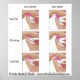 Temporomandibular joint dysfunction, TMJ or TMD Poster | Zazzle