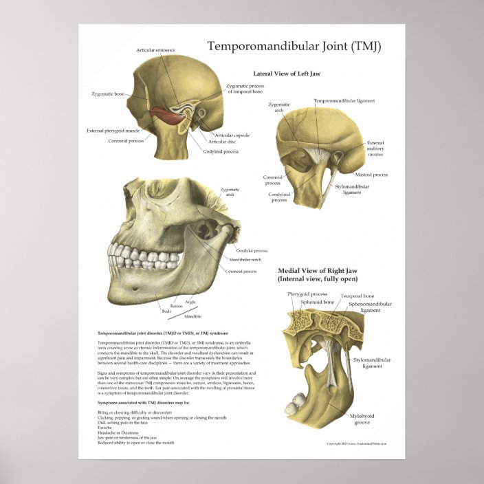 TMJ Joint Syndrome Anatomy Medical Poster | Zazzle.co.uk